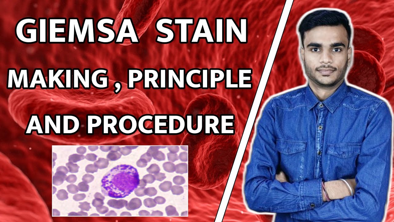 What Is Giemsa Stain | Giemsa Stain Procedure | Giemsa Staining ...