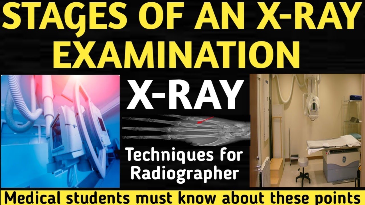 Stages of an X-ray examination (preparation for the x ray,undertaking ...