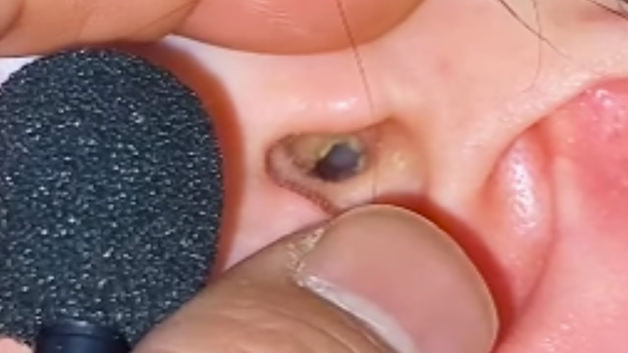Beautiful women pick ears. The whole process of ear picking with ...