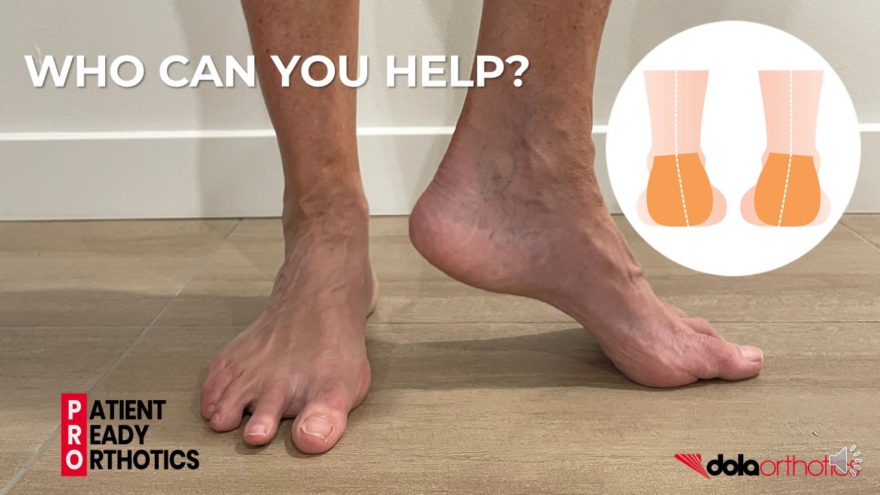DOLA Patient Ready Orthotics:: Supination - YouTube