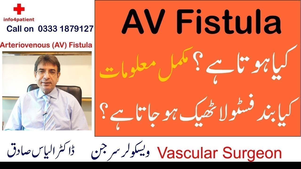 Arteriovenous (AV) fistula Best Vascular Surgeon| Dr. Ilyas Sadiq - YouTube