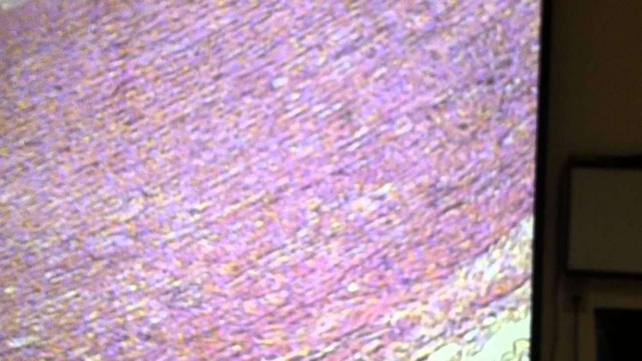 Dense Regular and Elastic Connective Tissue - YouTube