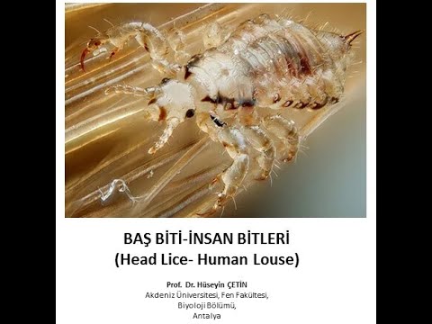 Baş bitinden nasıl kurtulurum?  - İnsan bitleri (Prof. Dr. Hüseyin ÇETİN) Head Louse- Human Lice