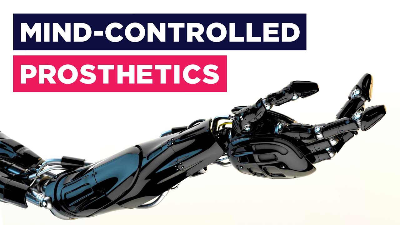 Mind Controlled Bionic Prosthetics Of The Future Youtube
