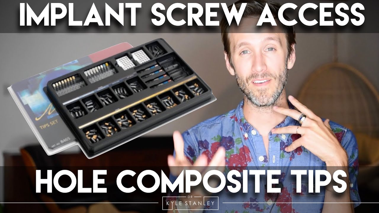 Implant Crown Screw Access Hole Composite -Dr. Kyle Stanley - YouTube
