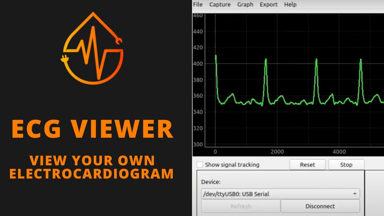 ECG Viewer Install for Windows and MacOS - YouTube