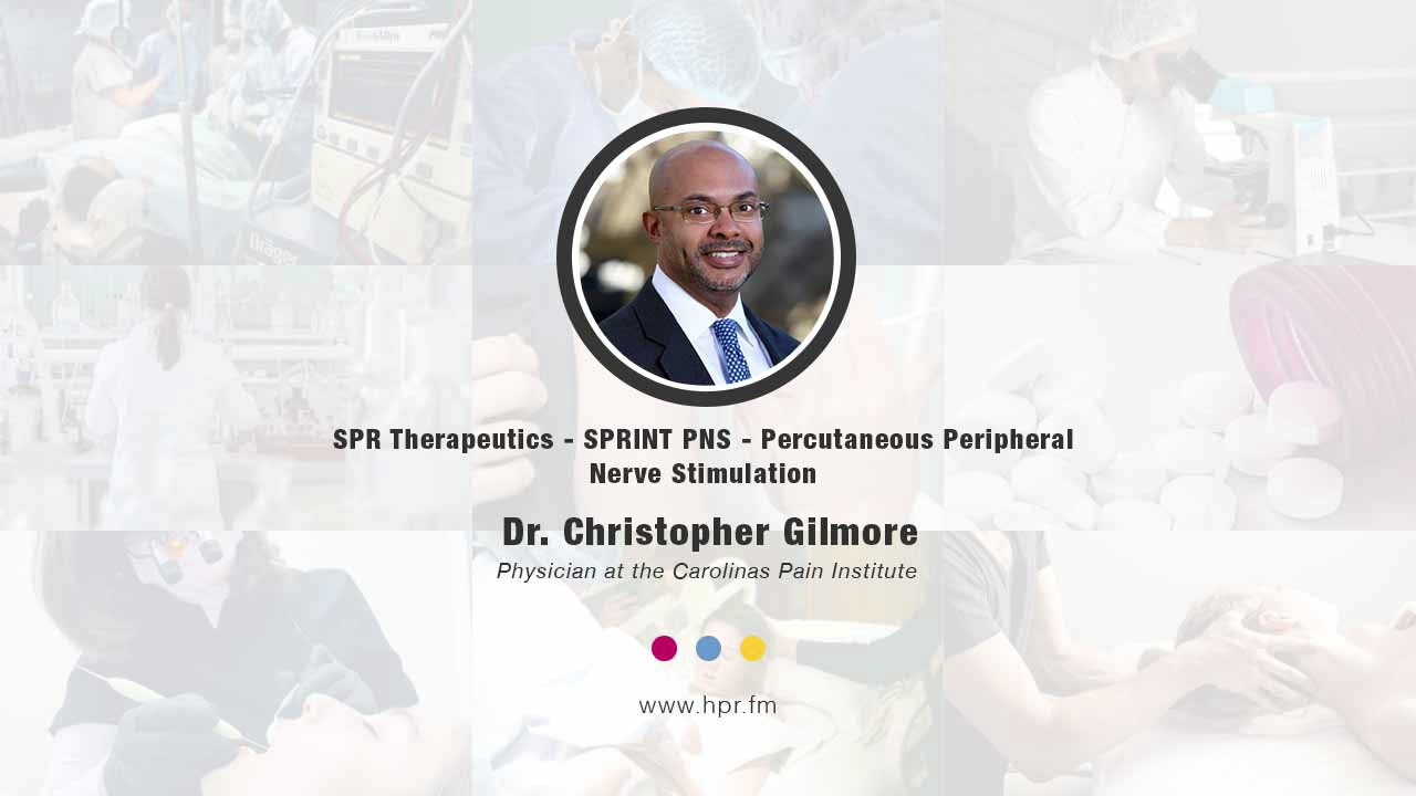 SPR Therapeutics - SPRINT PNS - Percutaneous Peripheral Nerve ...