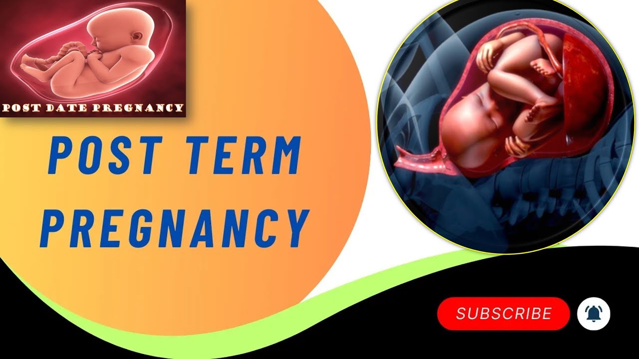 Postterm Pregnancy | Prolonged Pregnancy | Overdue Pregnancy ...