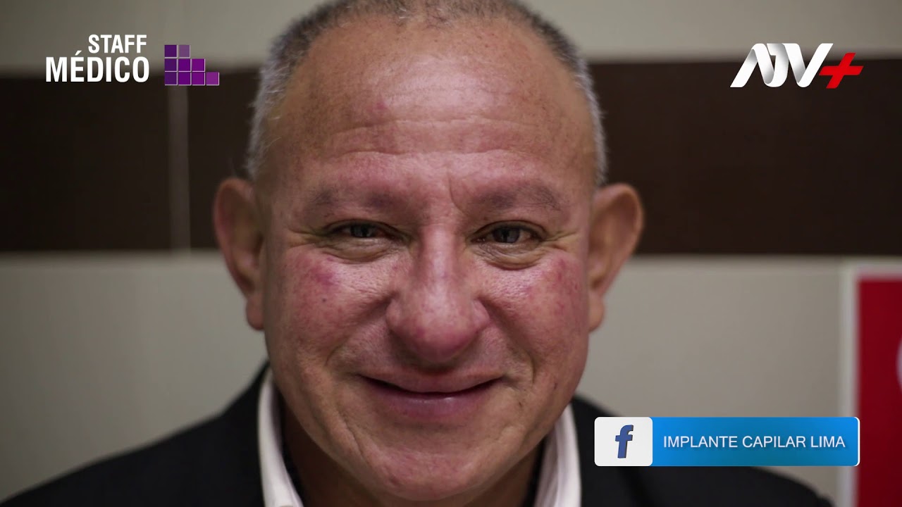 Botox Dr. Edwin Lazo - Programa Staff Médico - YouTube