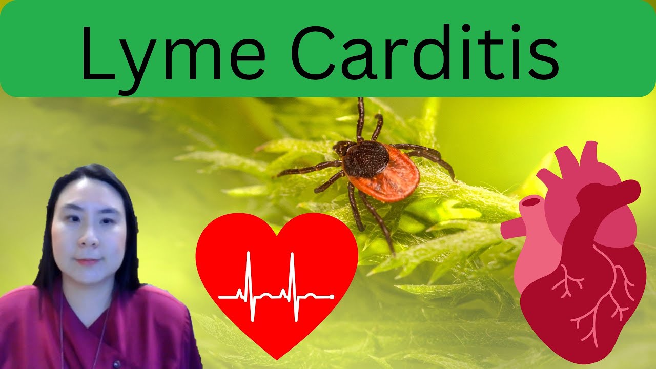 Lyme Carditis: Symptoms, Diagnosis, and Treatment #tickbites # ...