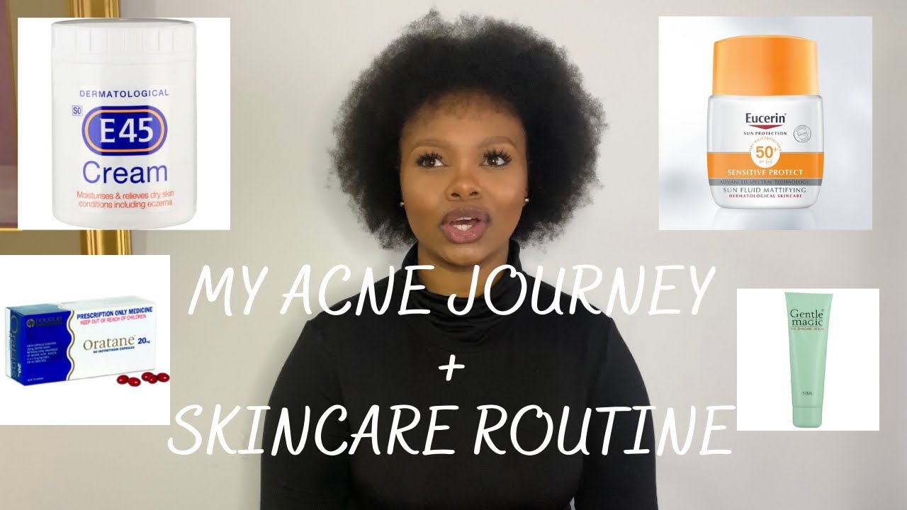 My Acne Journey: Oratane? + My Skincare Routine| Application Fee ...