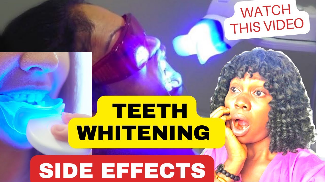 Side effects of TEETH WHITENING. Prepare your mind! #teethwhitening # ...