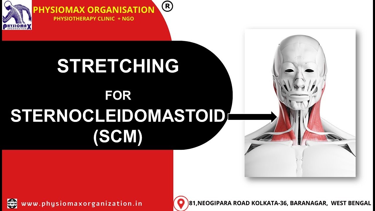 Sternocleidomastoid Stretching /Sternocleidomastoid/ Stretching/How to ...