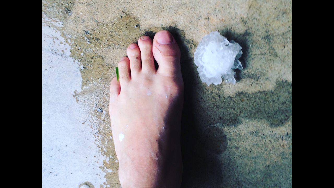 HIT IN THE HEAD BY MASSIVE HAIL - SYDNEY STORM FEB 2017 - YouTube