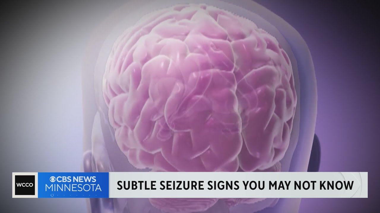 What Are The Symptoms And Signs Of A Seizure YouTube what-are-the-symptoms-and-signs-of-a-seizure-youtube