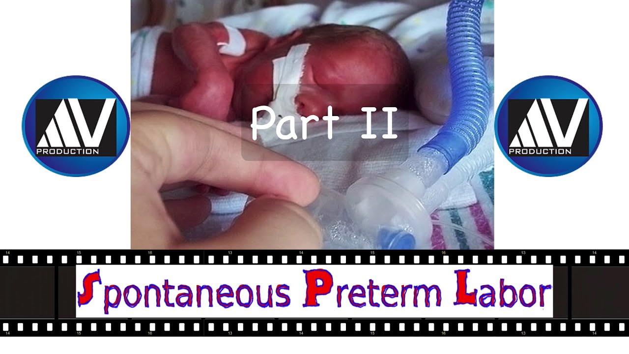 Spontaneous Preterm Labor II - YouTube