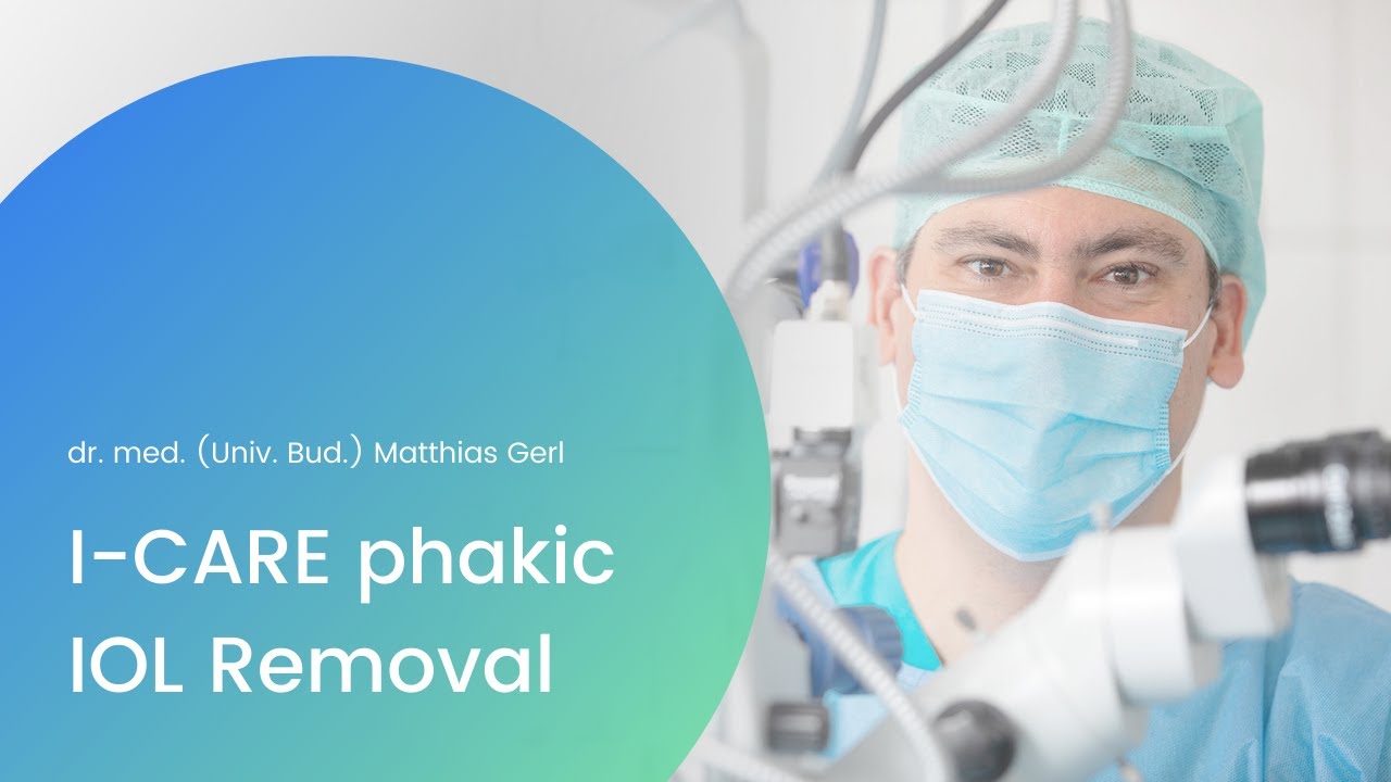 Cataract surgery with I-CARE phakic IOL removal and Alcon Vivity ...