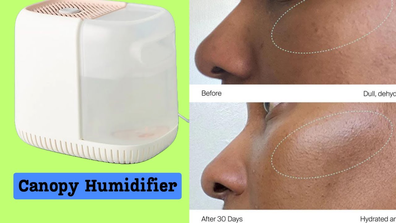 Canopy Humidifier Review: The Best Choice for Your Home? - YouTube