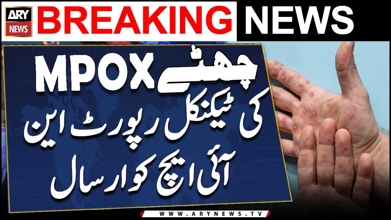 NIH gets technical report of sixth Monkeypox case in Pakistan - YouTube