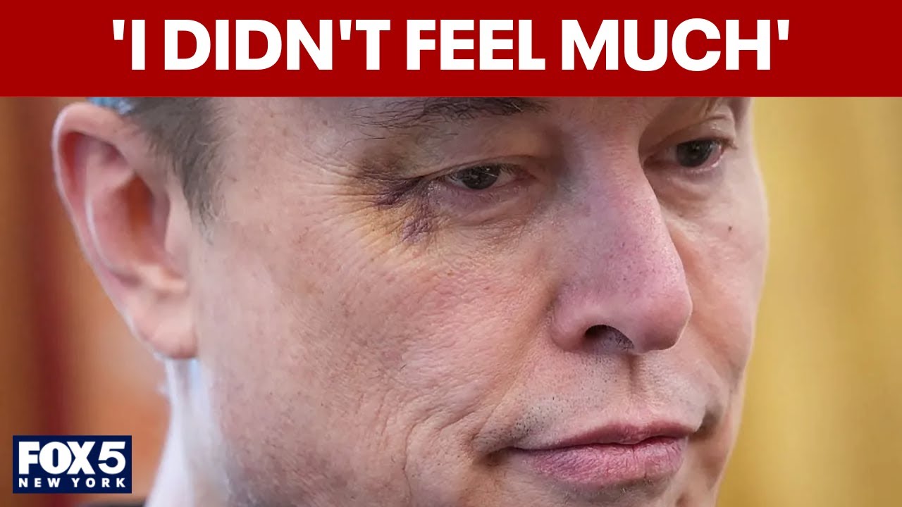 Elon Musk explains what happened to his eye - YouTube