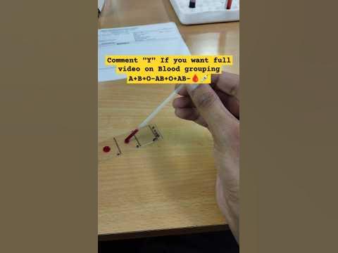 Blood Grouping | Blood group Detection - YouTube
