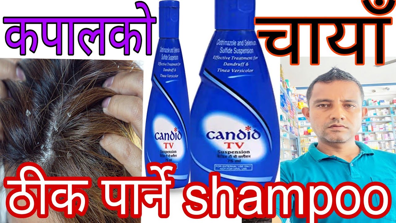 candid tv shampoo uses in Nepali |चायाॅंको उपचार गर्नु औषधि कसरी लगाउने ...