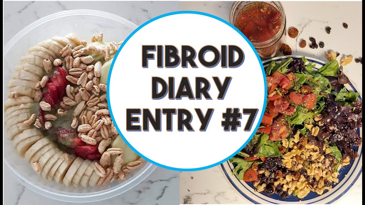 My Fibroid Diary 7 | Eating and Working Out - YouTube