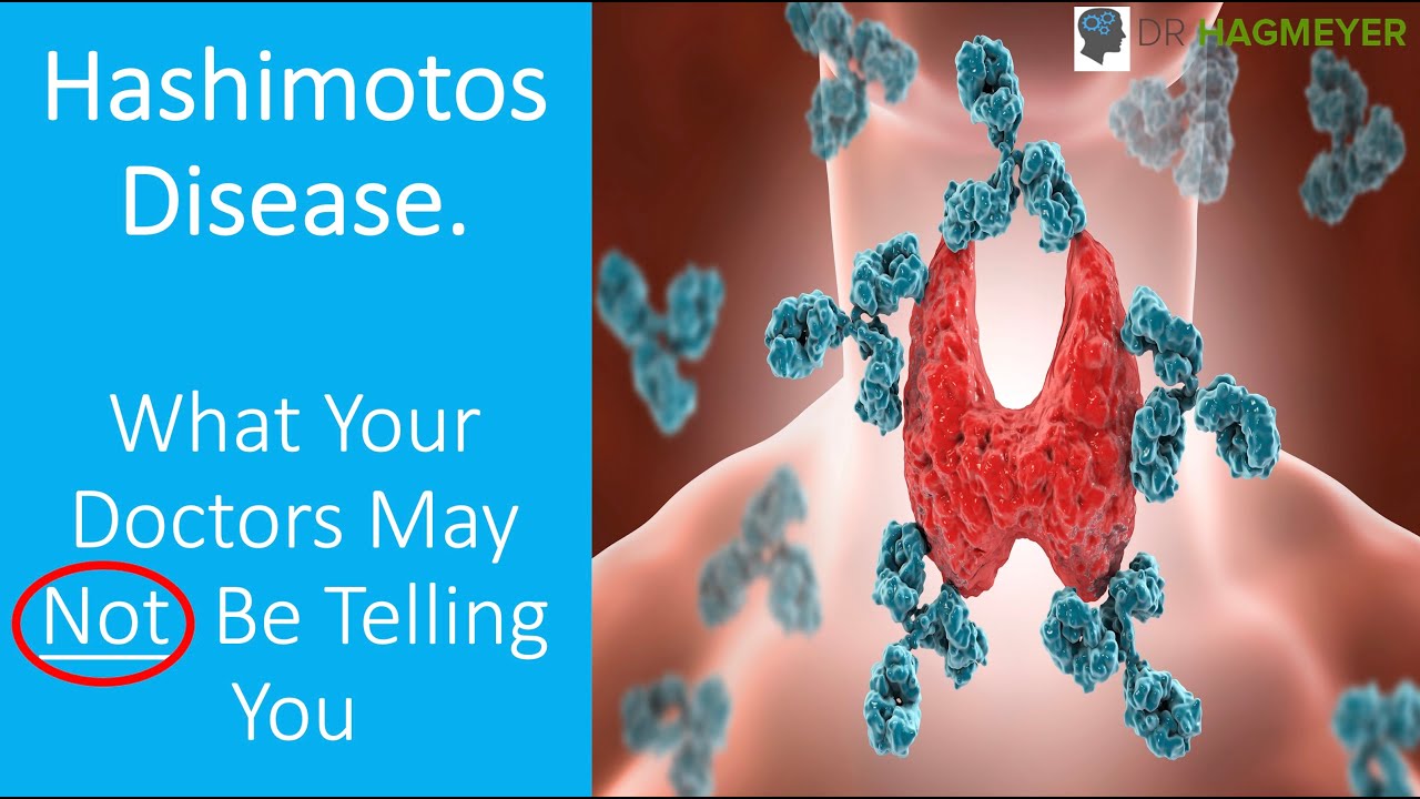 Hashimotos What IS It? and What Your Doctor May NOT Be Telling You ...