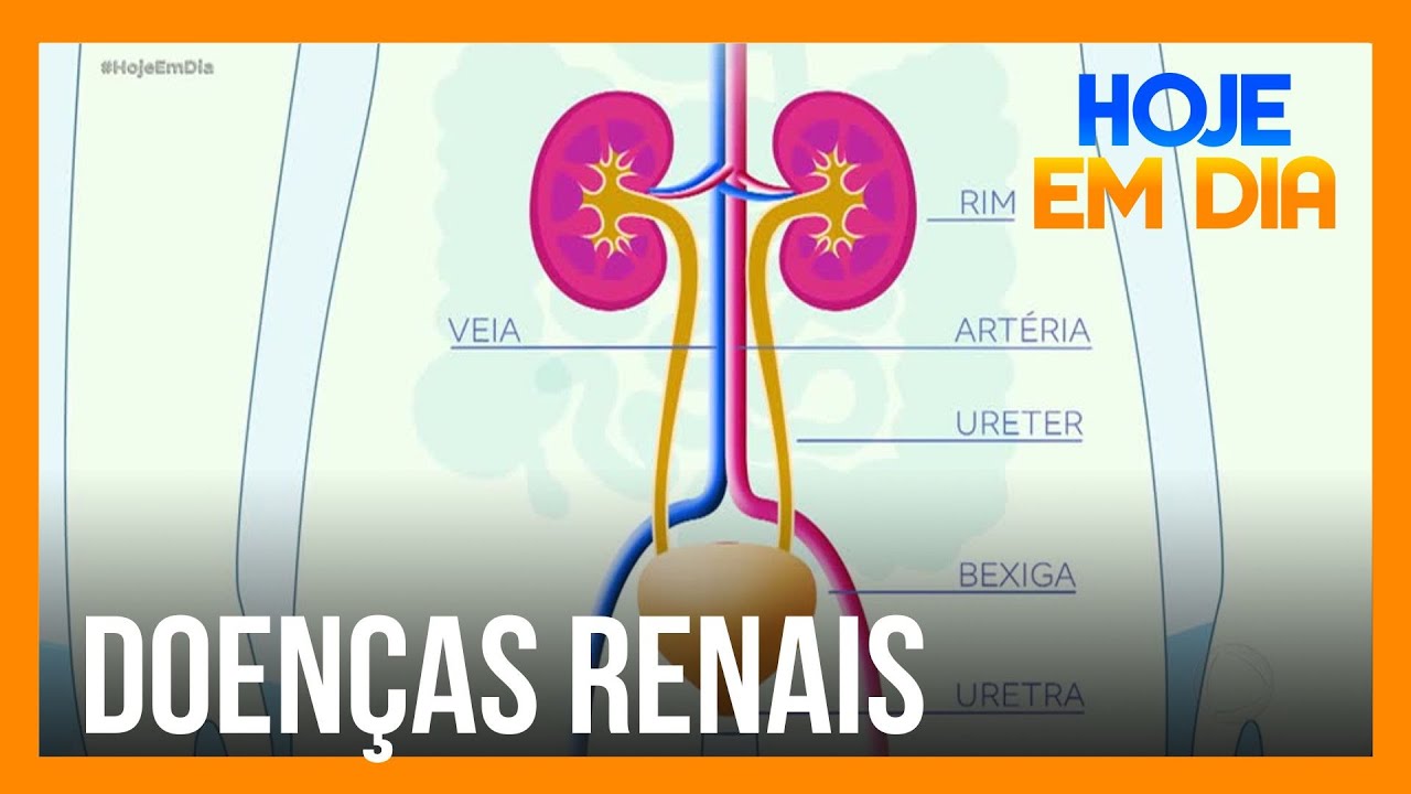Você e o Doutor: Antonio Sproesser tira dúvidas sobre as doenças renais ...