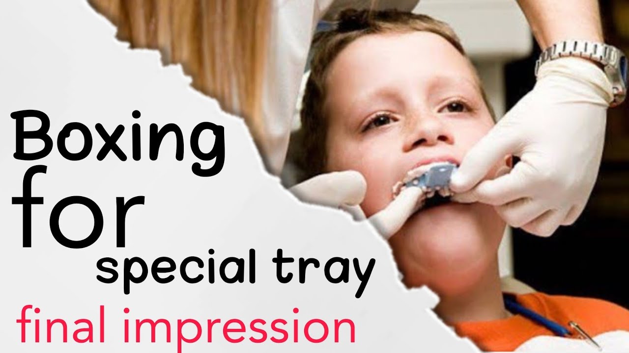 Boxing for final impression - YouTube