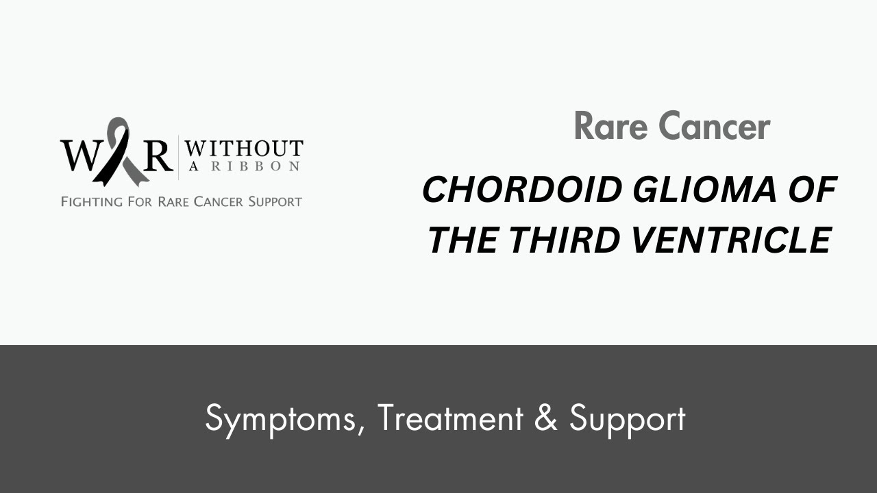 Chordoid Glioma of the Third Ventricle - YouTube