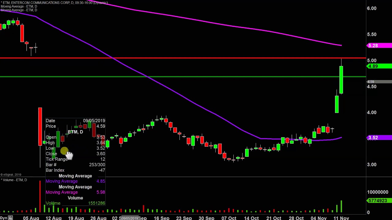 Entercom Communications Corp - ETM Stock Chart Technical Analysis for ...