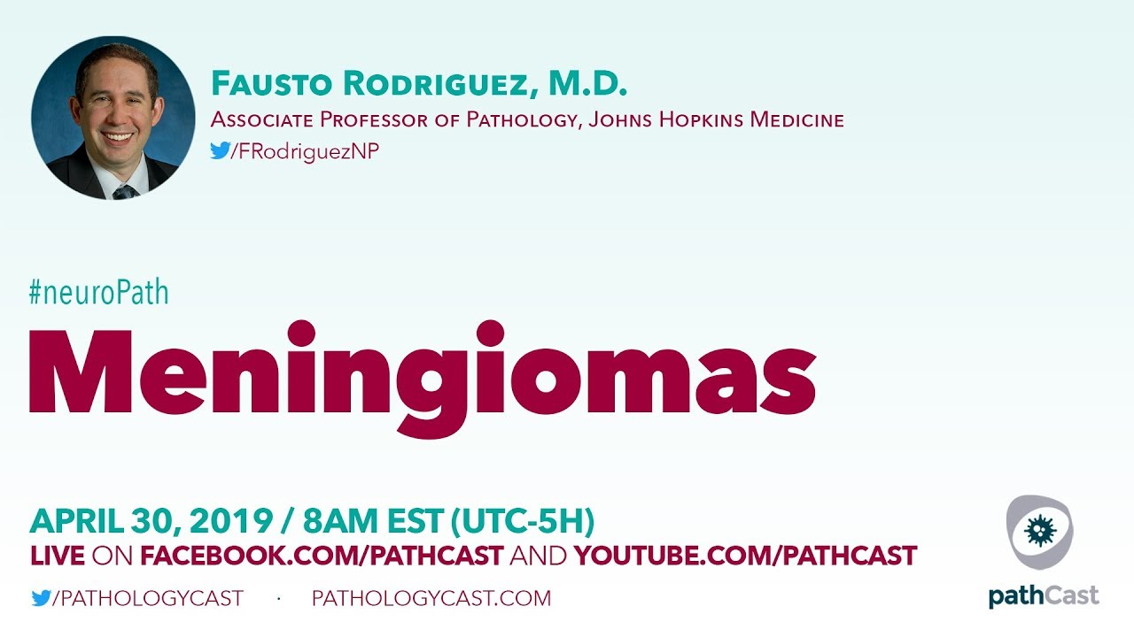 Meningiomas - Dr. Rodriguez (Hopkins) #NEUROPATH - YouTube