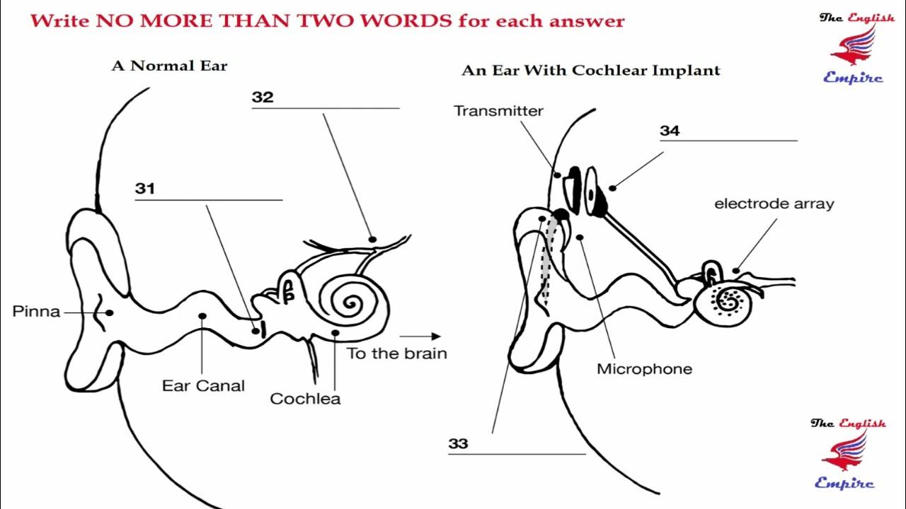 IELTS Listening Label a Diagram with Answers and Script - An Ear with ...