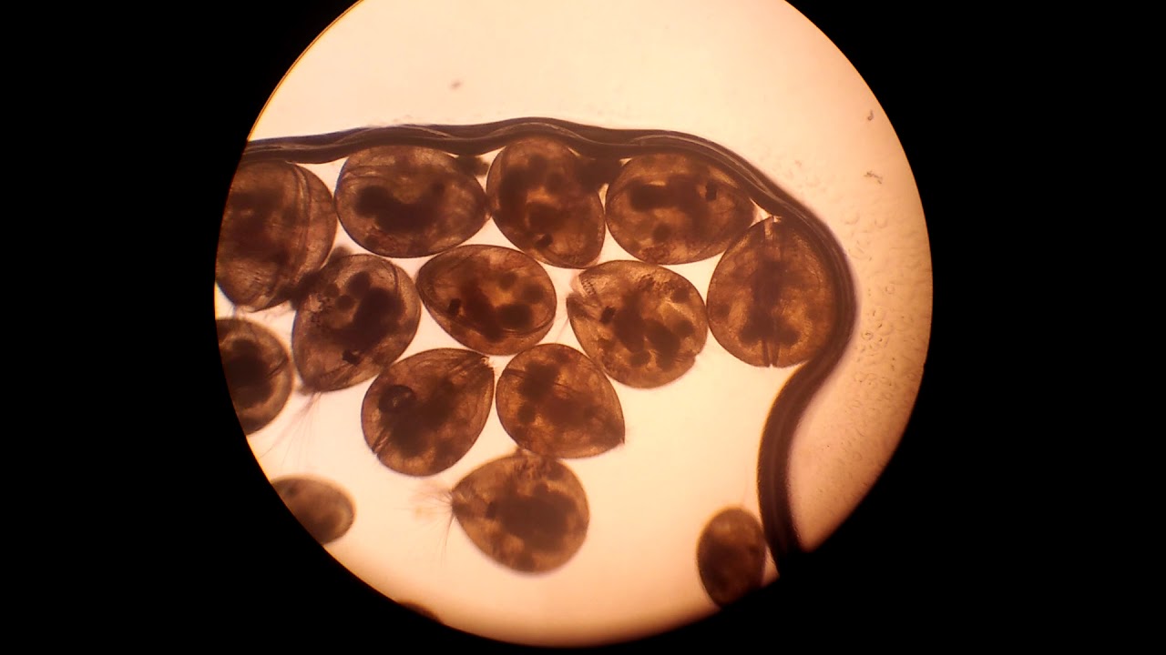 EGGS OF A CYCLOP UNDER THE MICROSCOPE! 🔬🔬🔬 - YouTube