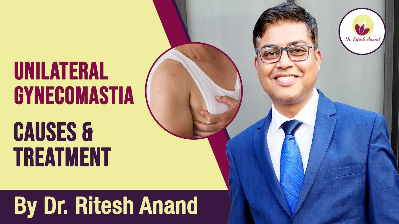 Unilateral Gynecomastia in Hindi - Types | Causes | Treatment | One ...