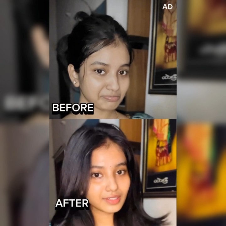 Chase the sun, not the damage! ☀ Pond’s Miracle SPF 50+++ keeps me ...