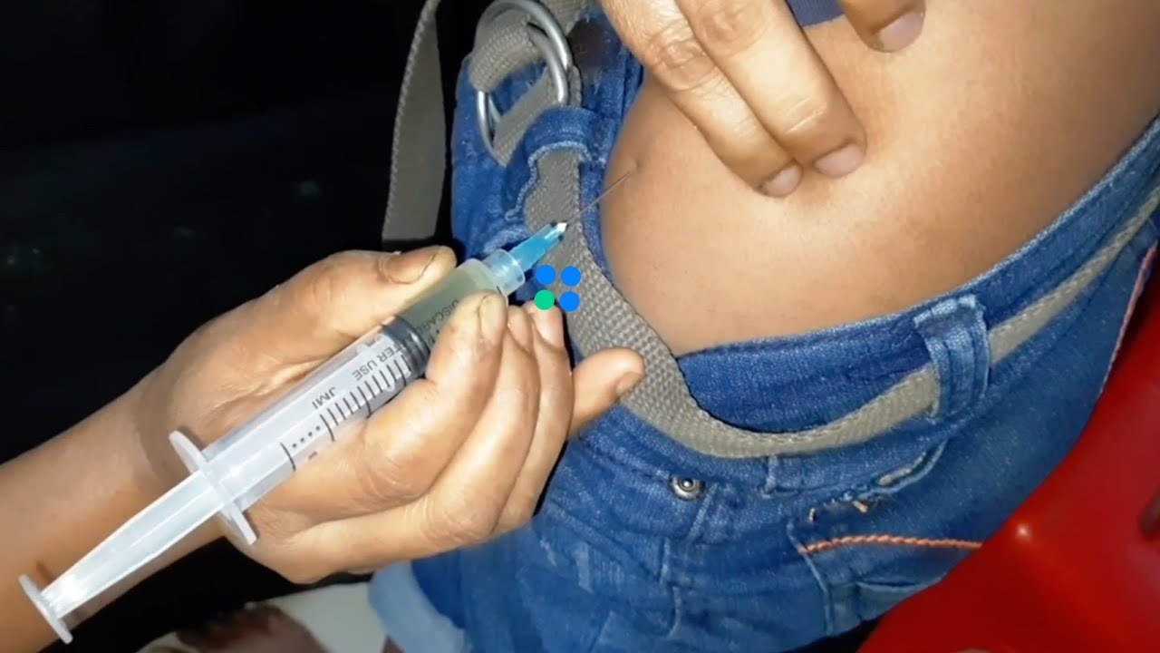 Buttock injection. im Injection. iv injection. WhatsApp Injection Video.24 Big Ep-144 injection ...