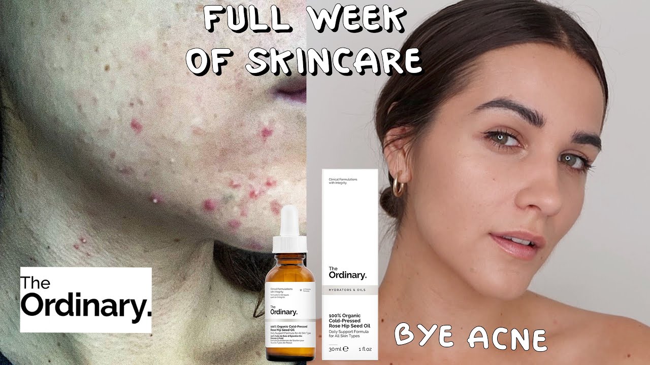 full week skincare that CLEARED my acne ft. The Ordinary - YouTube