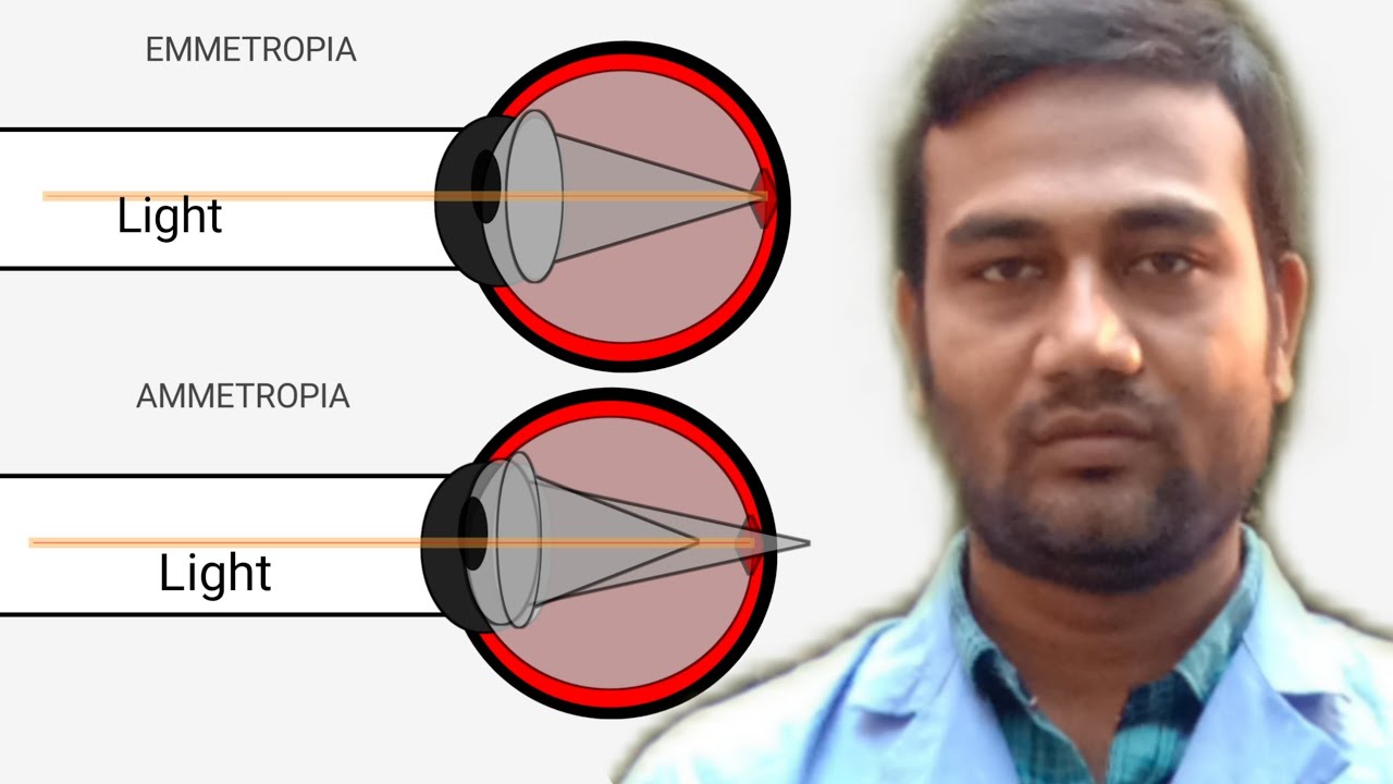 Emmetropia and Ametropia pronunciationEmmetropia এবং Ametropia ‌বিএস ...
