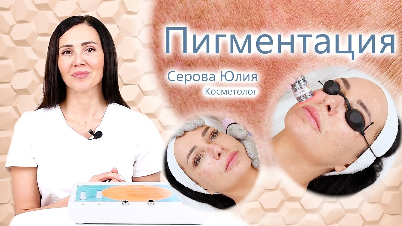 🔬 Пигментация на коже способы решения проблемы Youtube