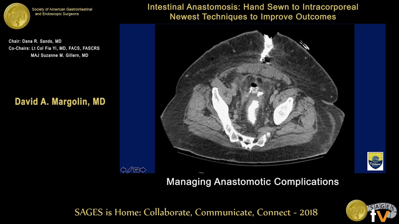 Management of anastomotic complications - YouTube