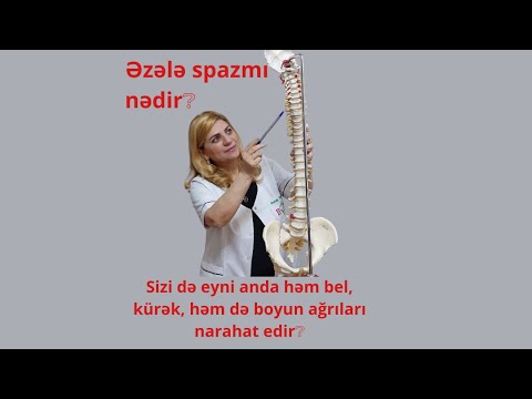 ƏZƏLƏ SPAZMI NƏDİR❓EYNİ ANDA #belagrisi ,#kürekagrisi, həm də #boyunağrısı, #qolağrısı NARAHAT EDİR❓