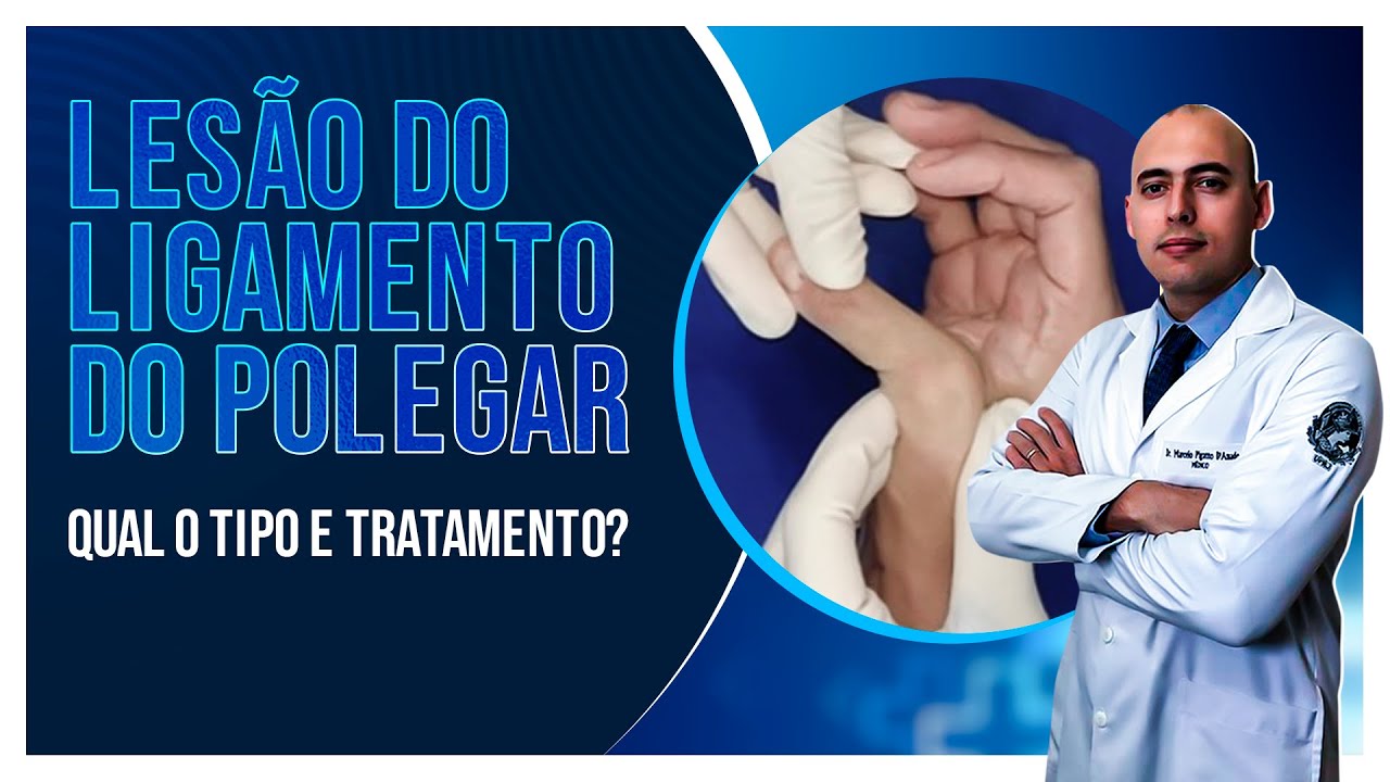 Ressonancia Magnetica Do Polegar Do Ligamento Colateral Radial Lesão