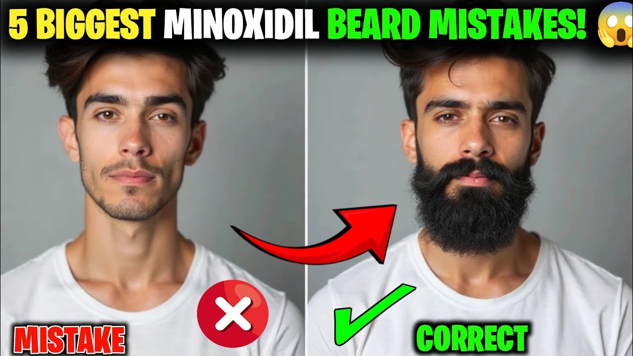 5 Minoxidil Beard Mistakes That KILL Your Growth | Fix Them Now ...