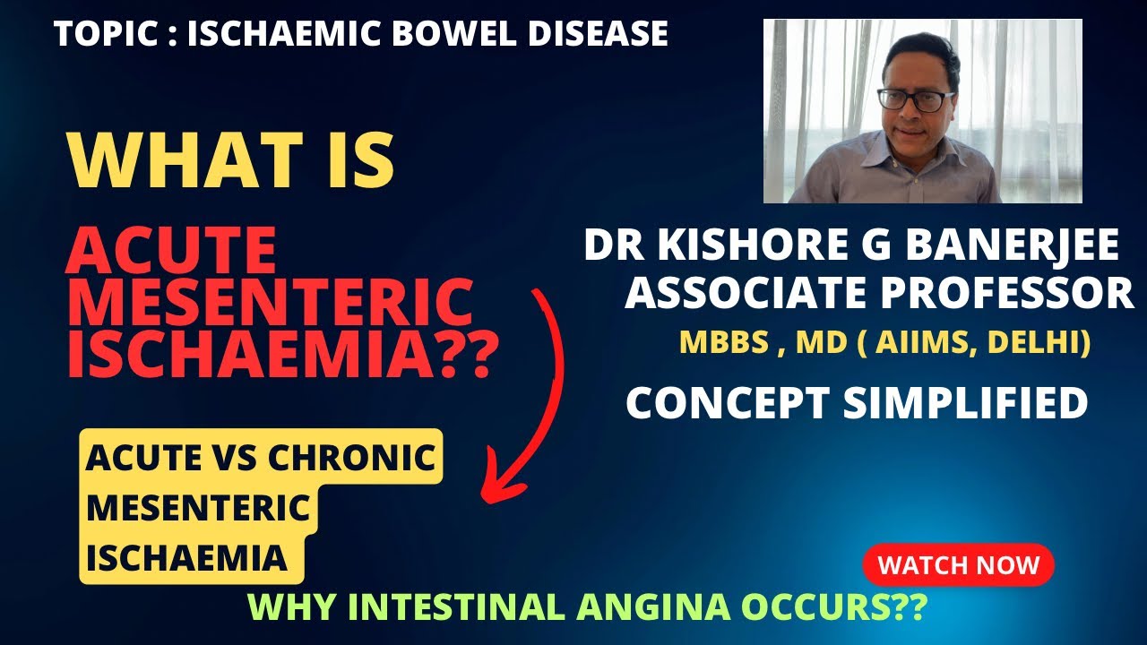 Acute Mesenteric Ischaemia Vs Chronic Mesenteric Ischaemia; What’s ...
