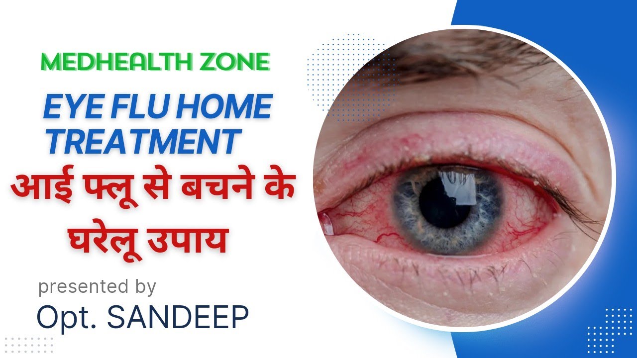 EYE FLU HOME TREATMENT IN HINDI | Eye flu का घरेलू इलाज | MedHealth ...