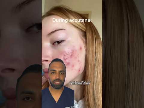 How Quickly Does Accutane Work For Mild Acne
