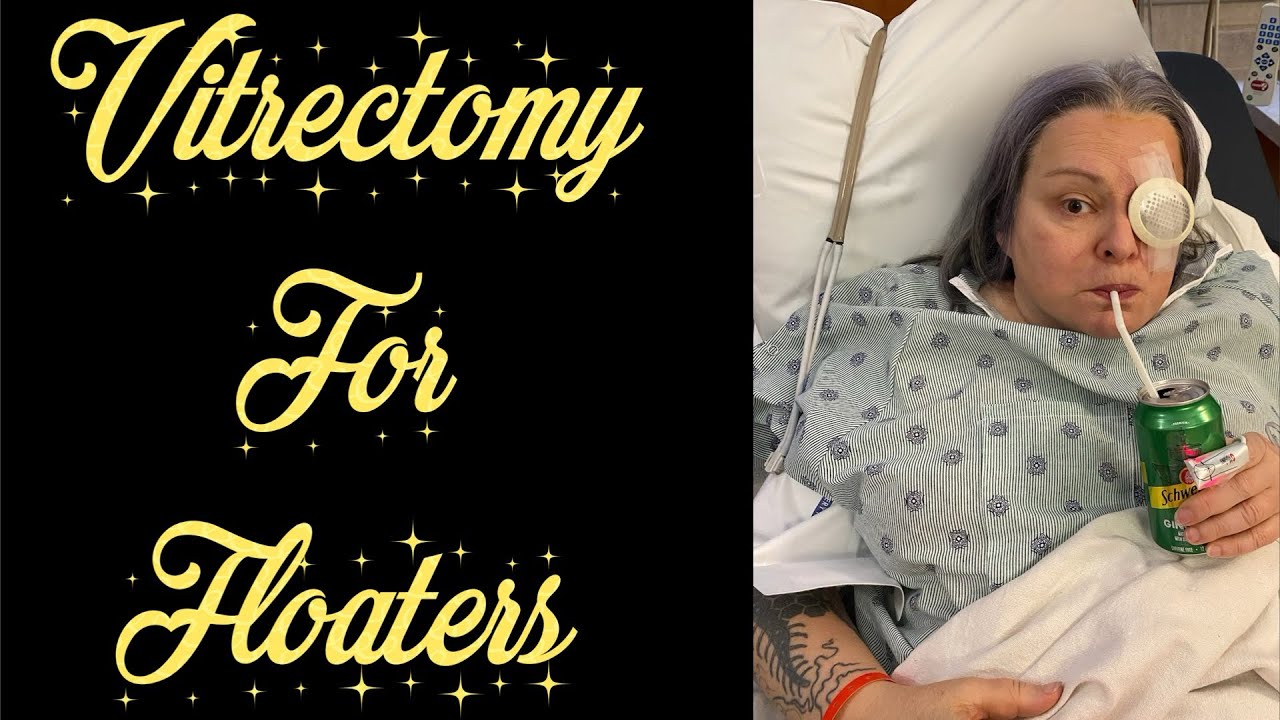 Vitrectomy Eye Surgery | Floaters, #eyes, #surgeryrecovery, # ...