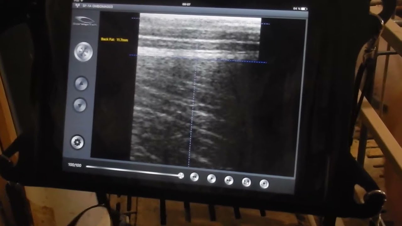 Imaging Depth - Wireless Ultrasound Scanner - Back Fat and Muscle 5MHz ...